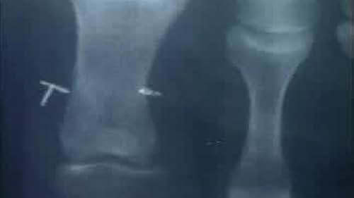 Alien Implants: Evidence and Purpose